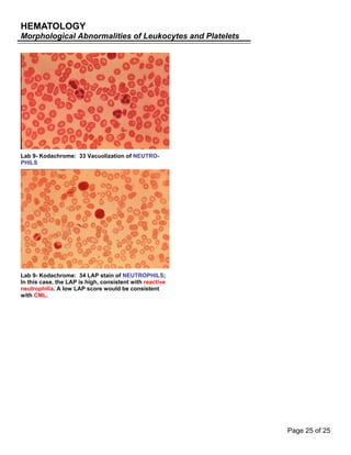 Hematology | PDF