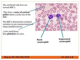 Hematology | PPTX