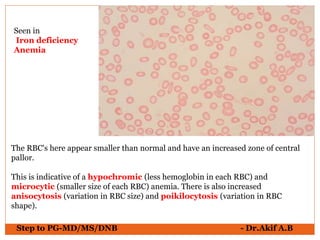 Hematology | PPTX