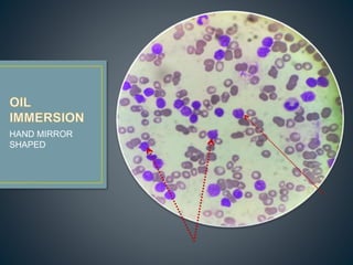 hematology equas case of acute leukemia.pptx