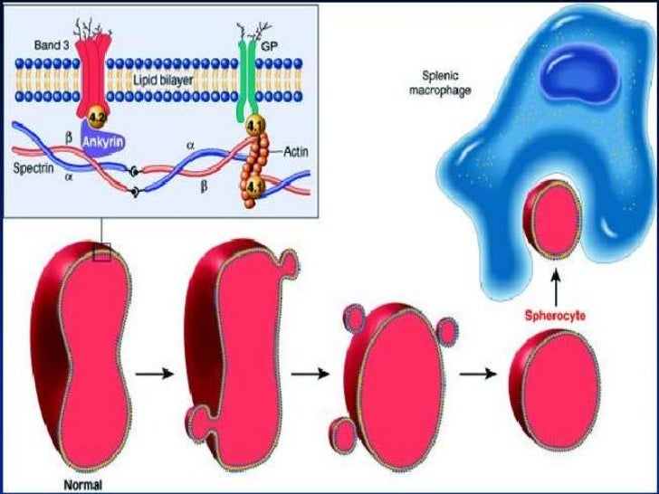 Spherocytosis Causes