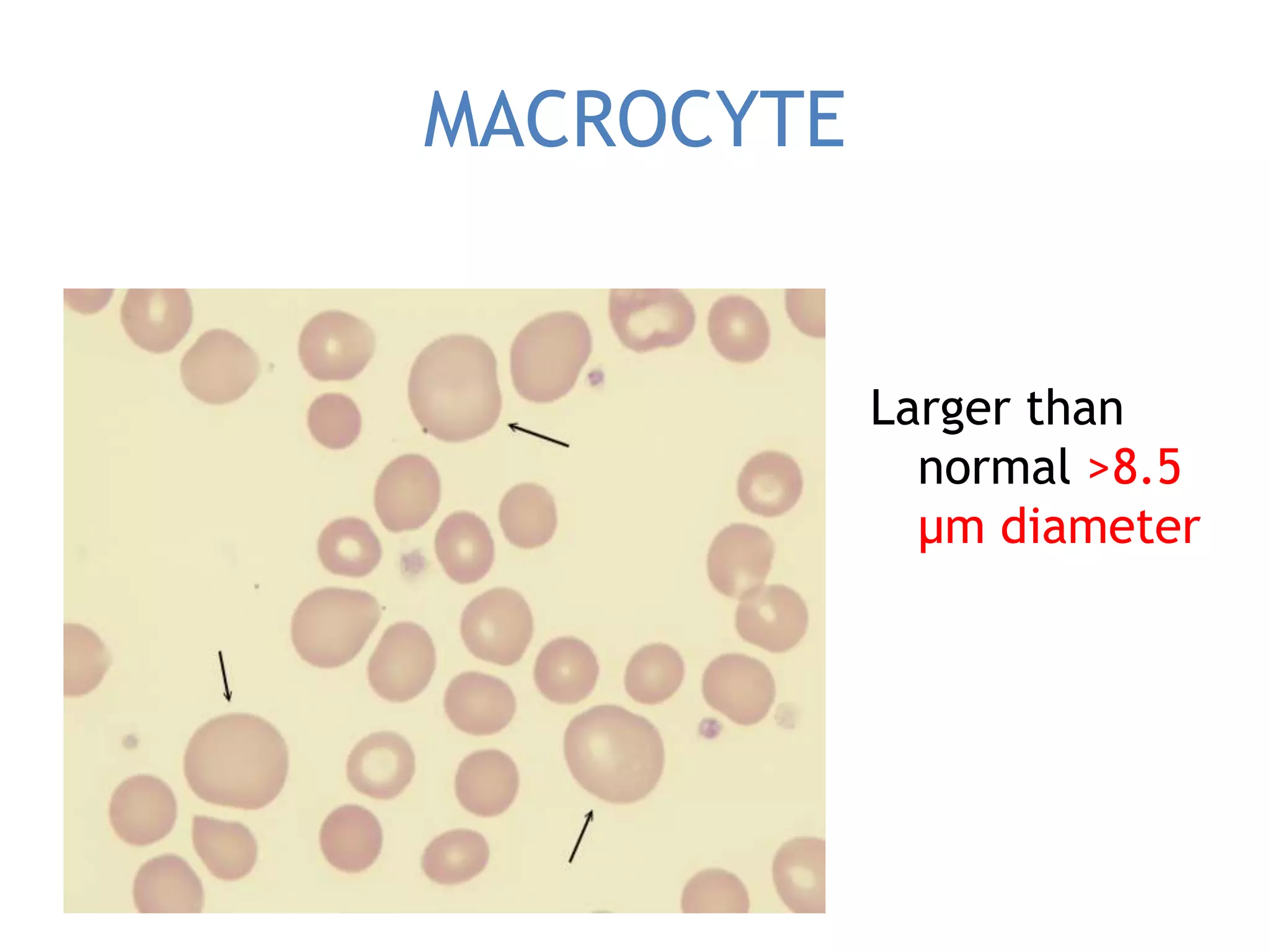 Introduction to Hematology and Anemia | PPTX