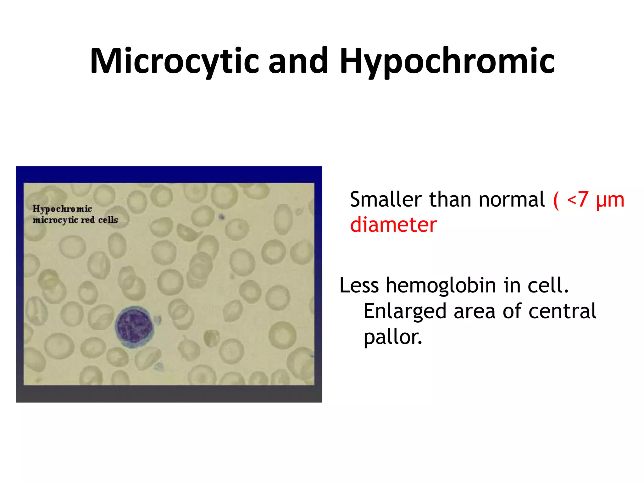 Introduction to Hematology and Anemia | PPTX