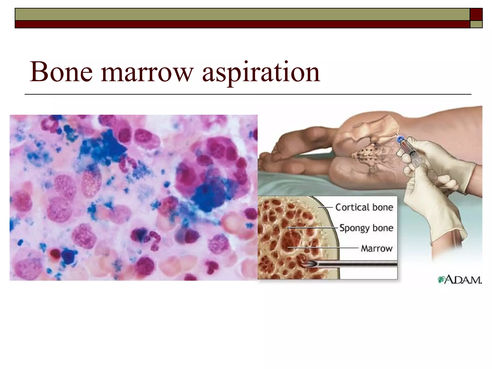 Hematology (1) The blood and bone marrow, abnormal blood count, anemias ...