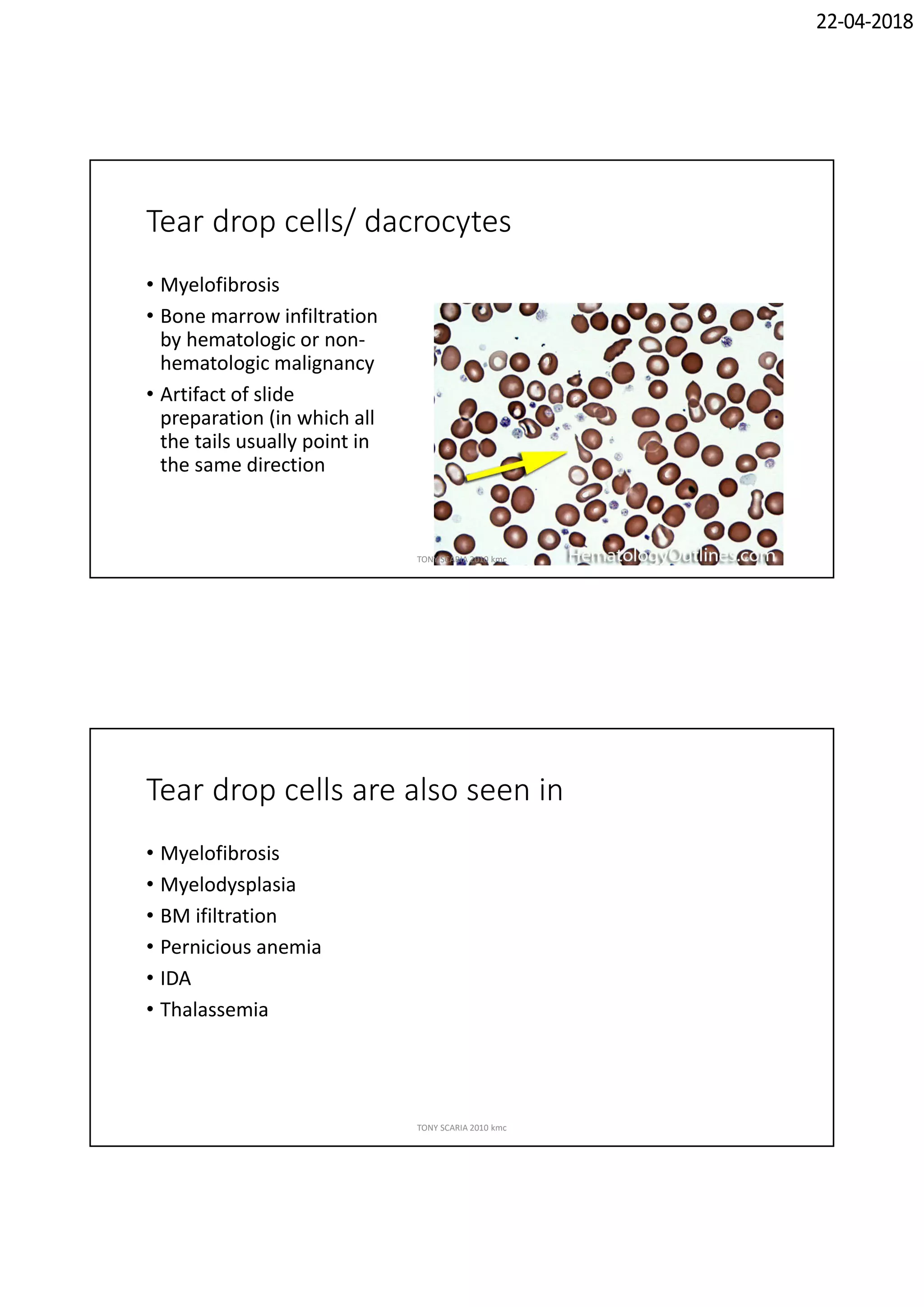 Hematology revision notes pathology | PDF