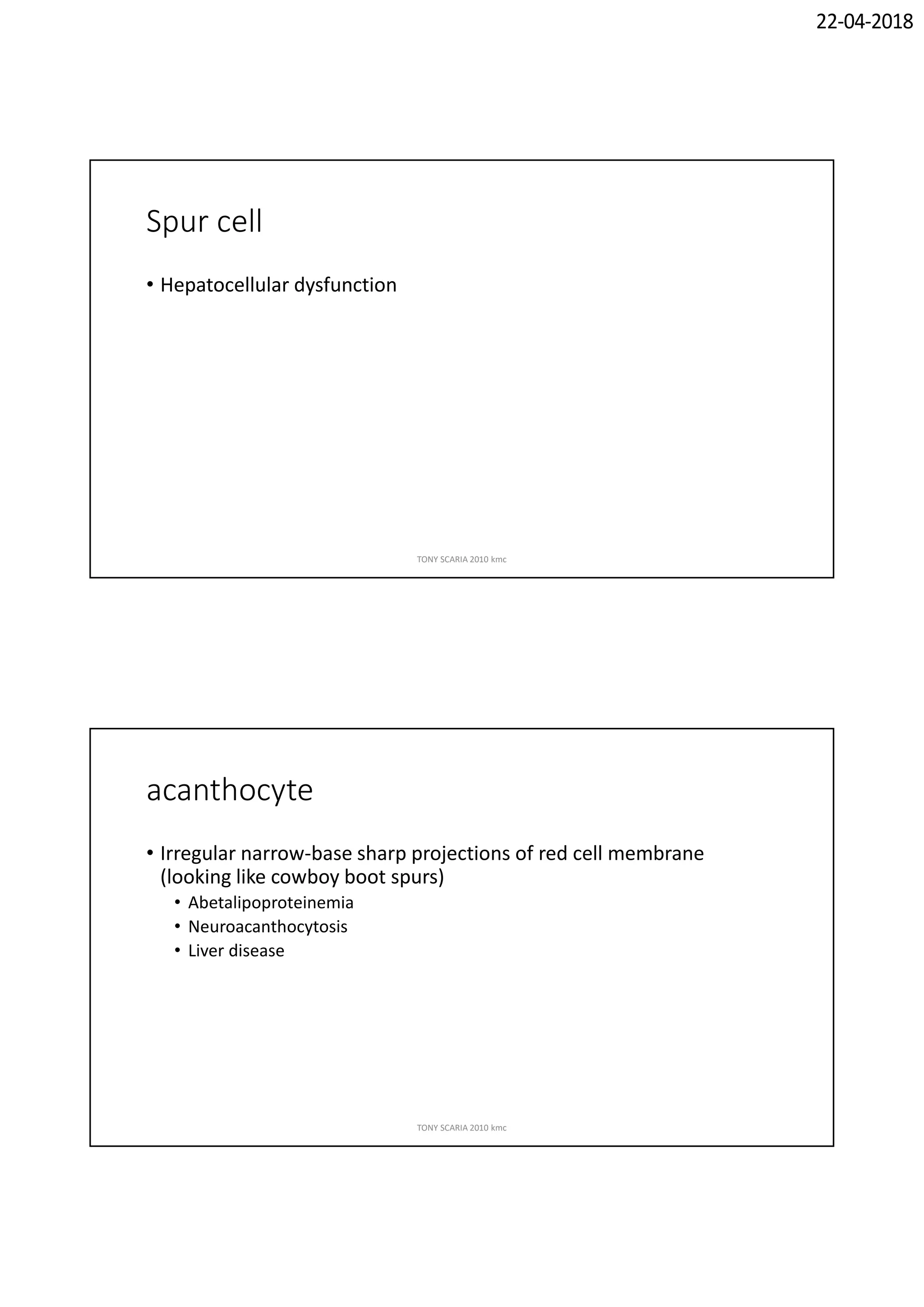 Hematology revision notes pathology | PDF