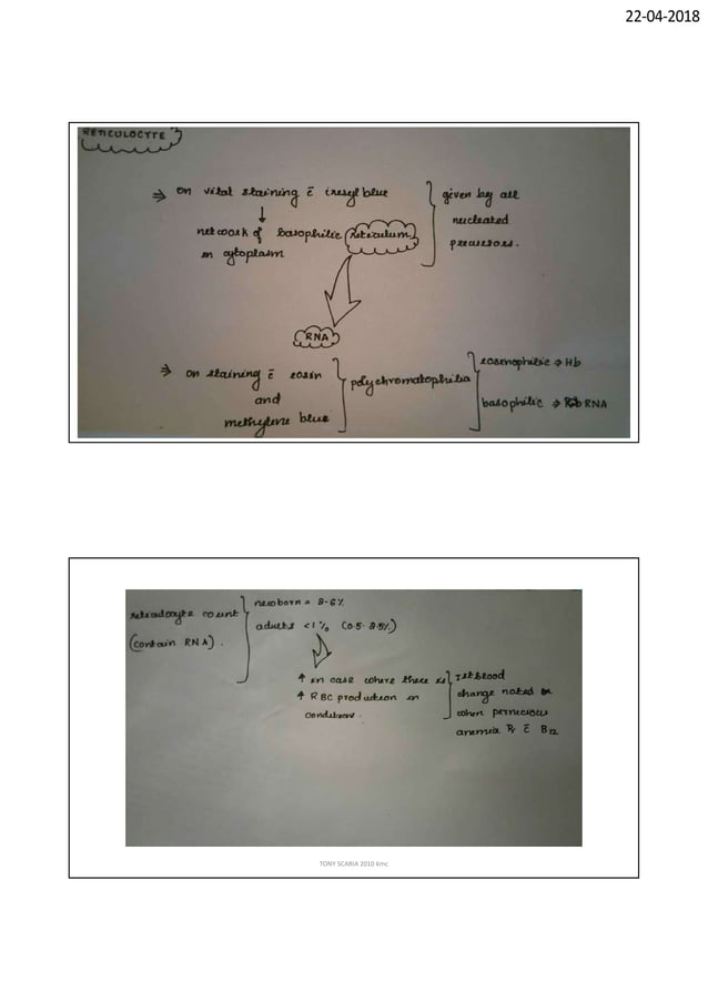 Hematology revision notes pathology | PDF