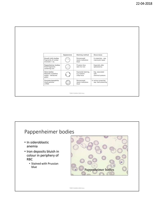 Hematology revision notes pathology | PDF