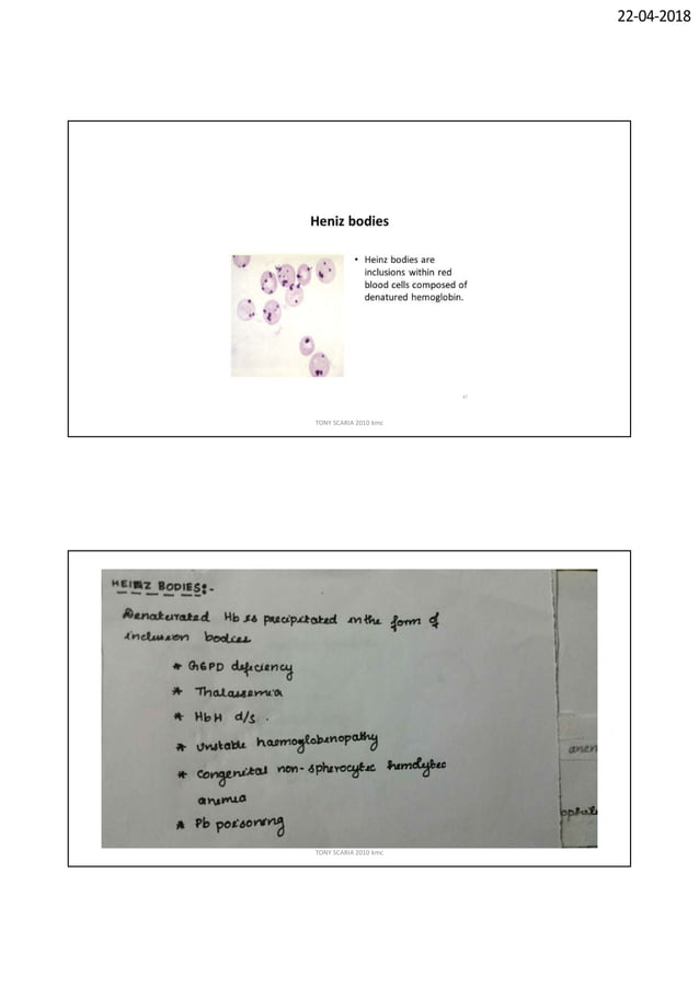 Hematology revision notes pathology | PDF