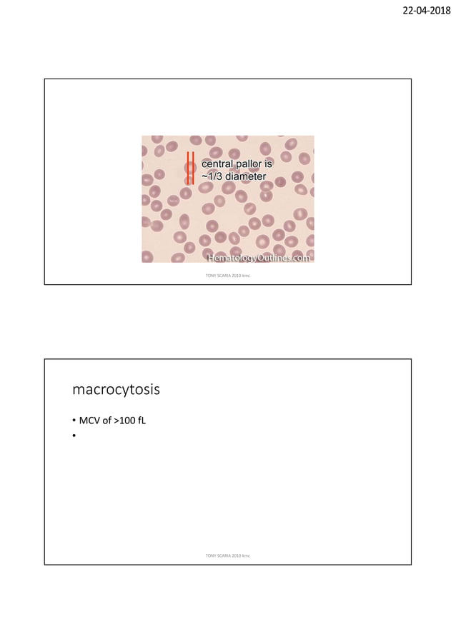Hematology revision notes pathology | PDF