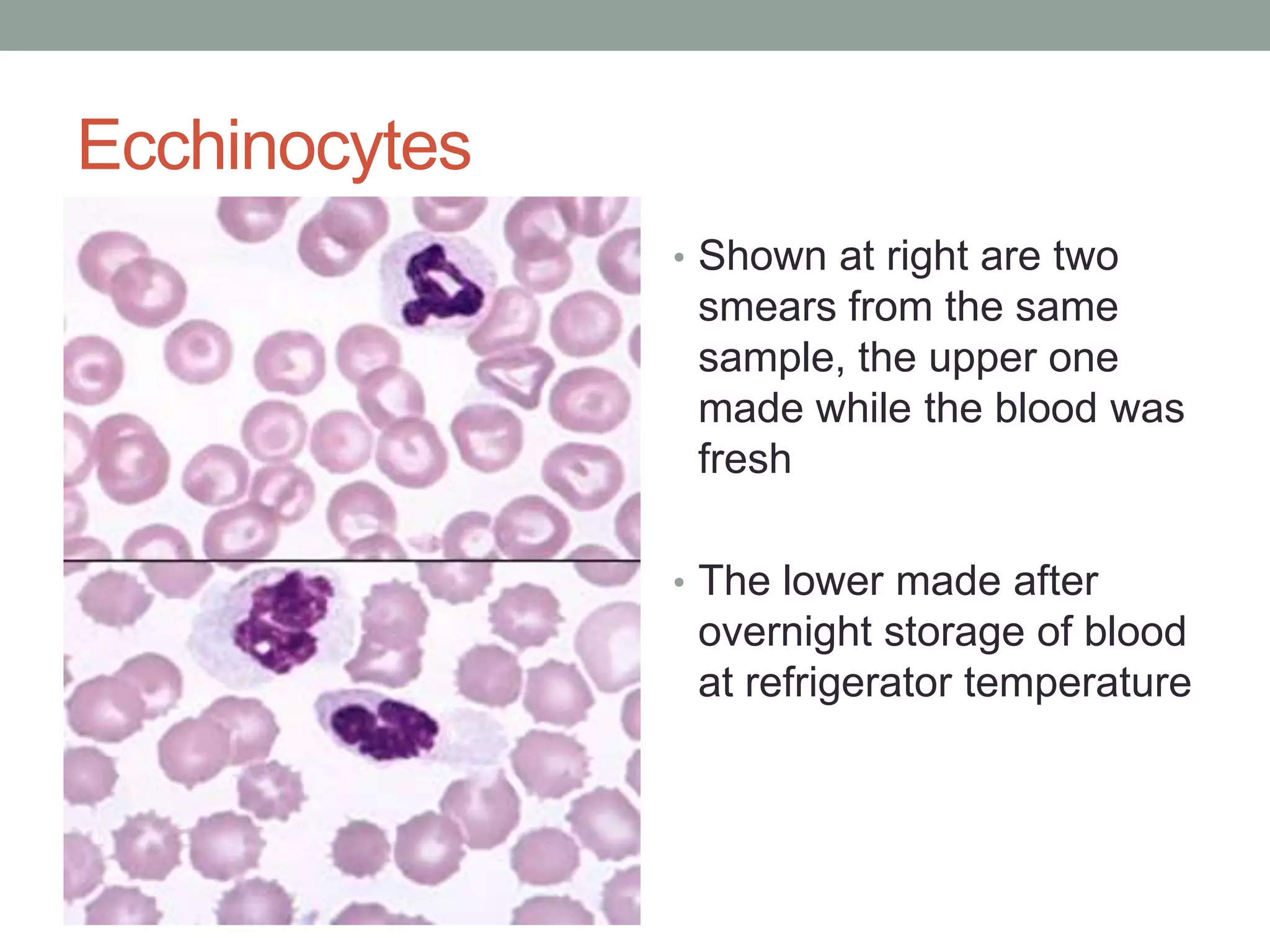 Hematology basics pt 1 jpg | PPTX