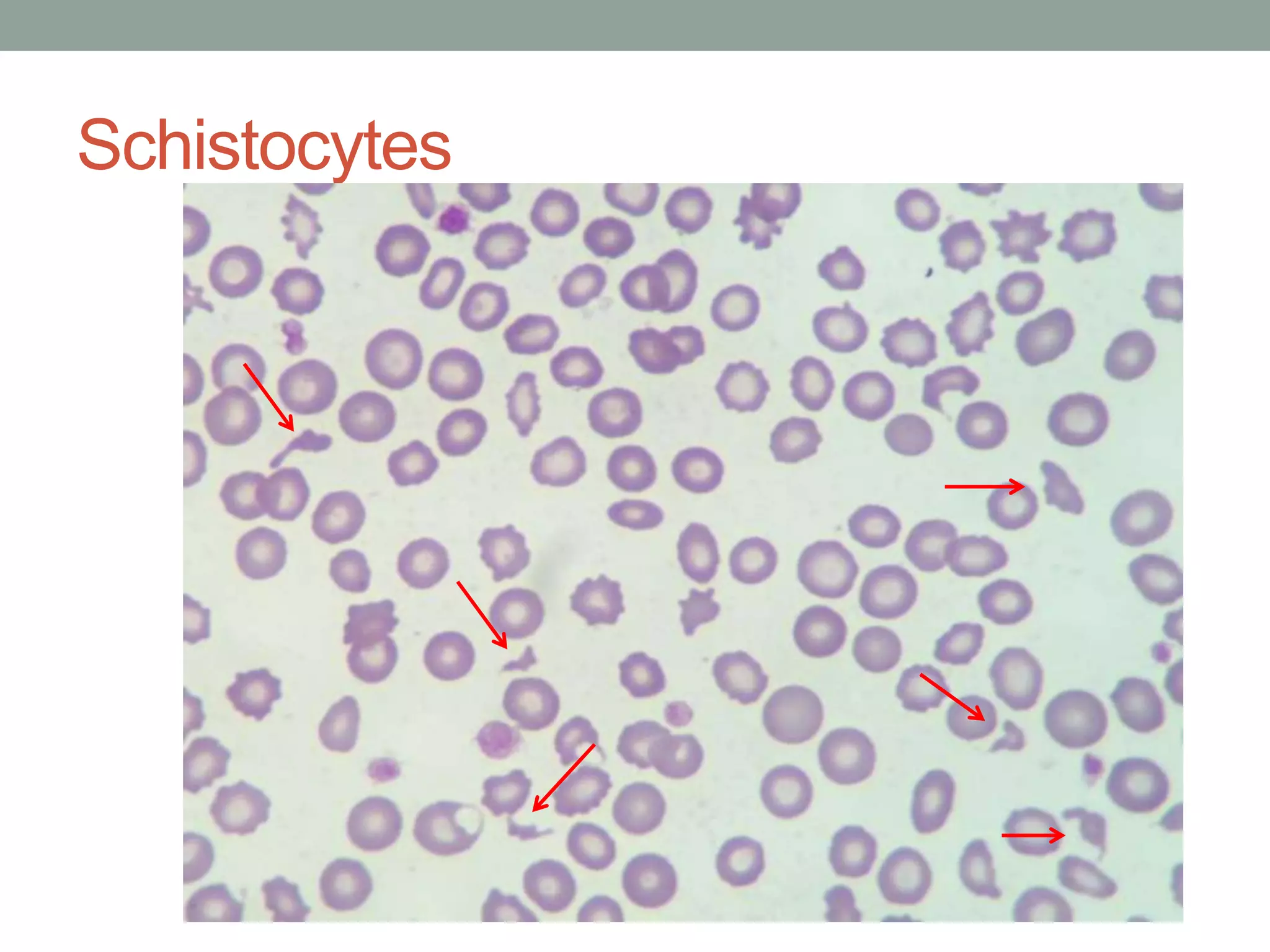 Hematology basics pt 1 jpg | PPTX