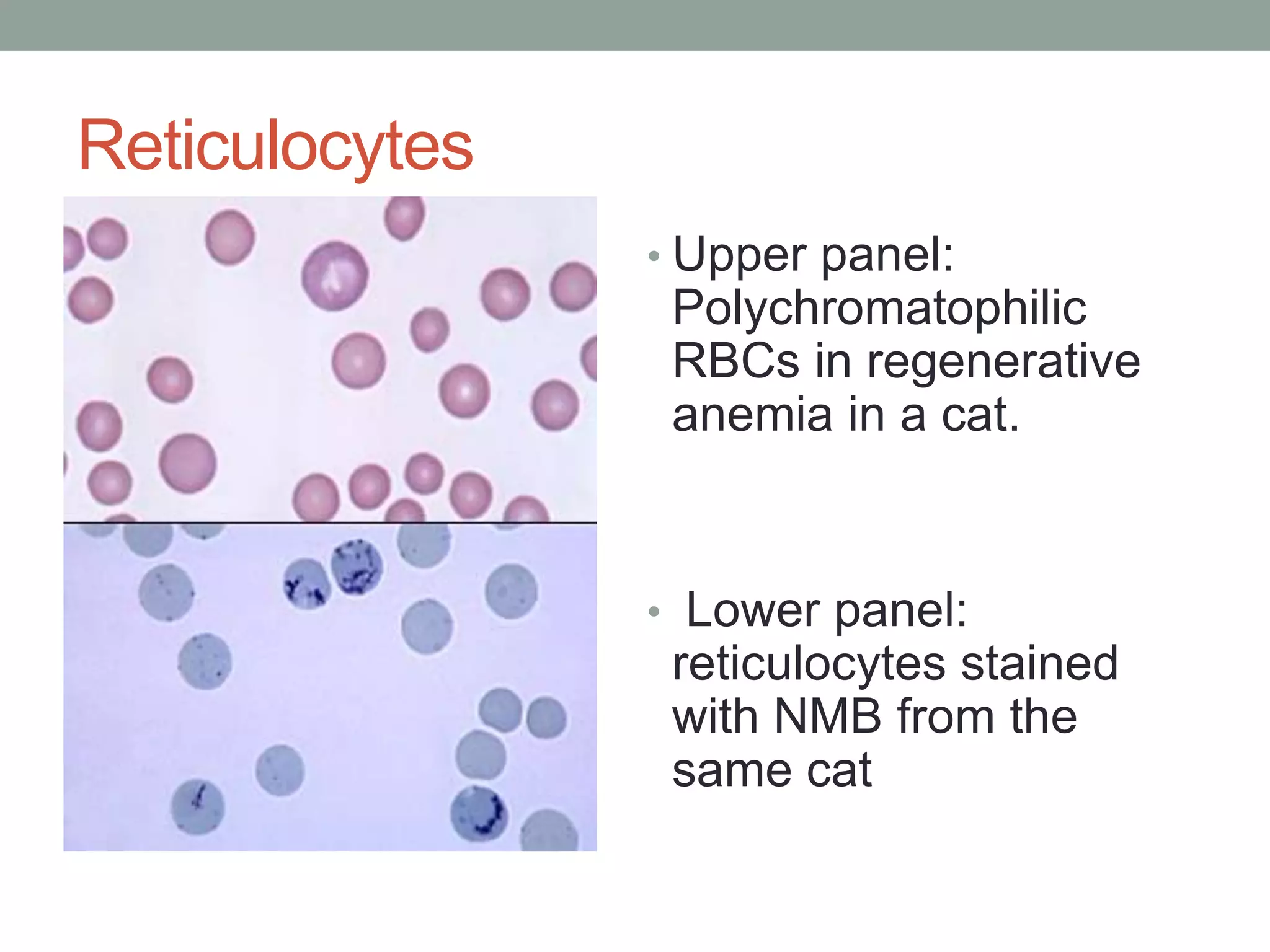 Hematology basics pt 1 jpg | PPTX