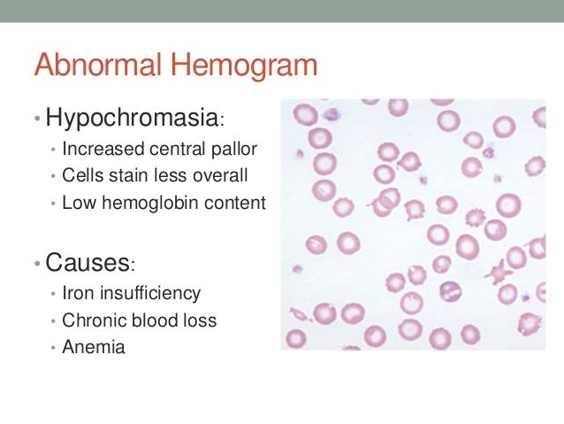 Hematology basics pt 1 jpg