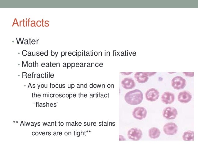Hematology basics pt 1 jpg