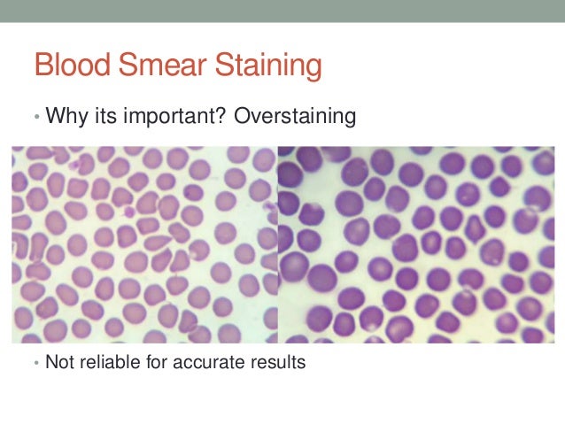 Hematology basics pt 1 jpg