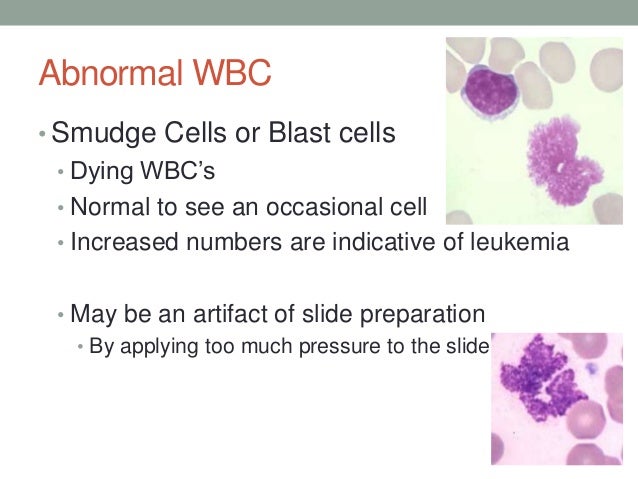 Hematology basics pt 2
