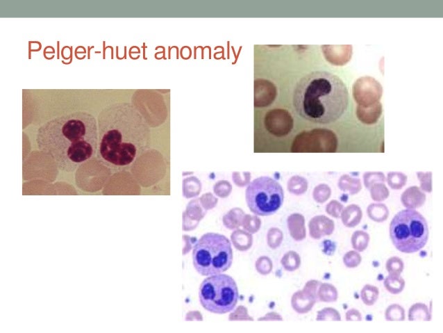 Hematology basics pt 2