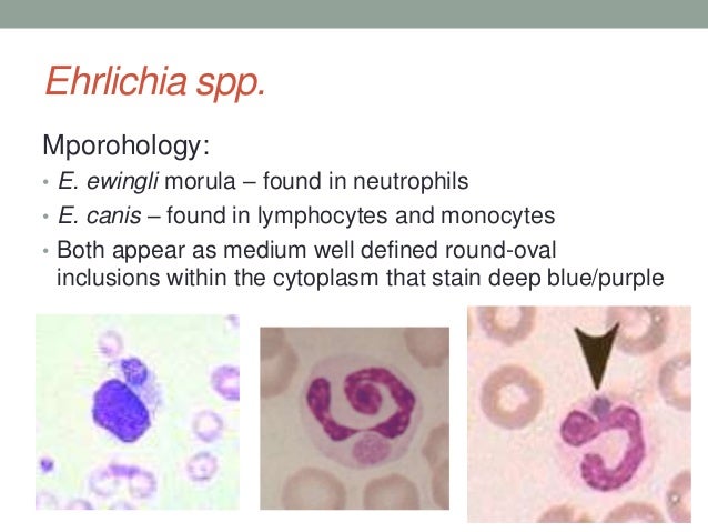 Hematology basics pt 2