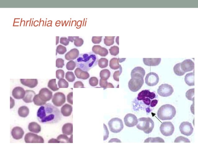 Hematology basics pt 2