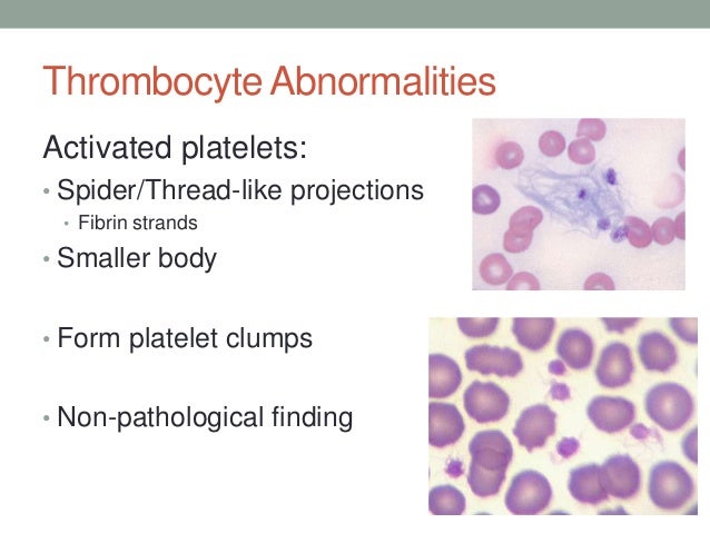 Hematology basics pt 2