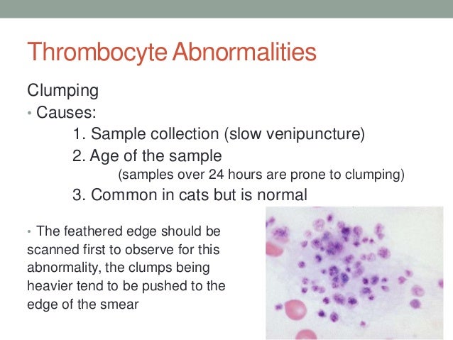 Hematology basics pt 2