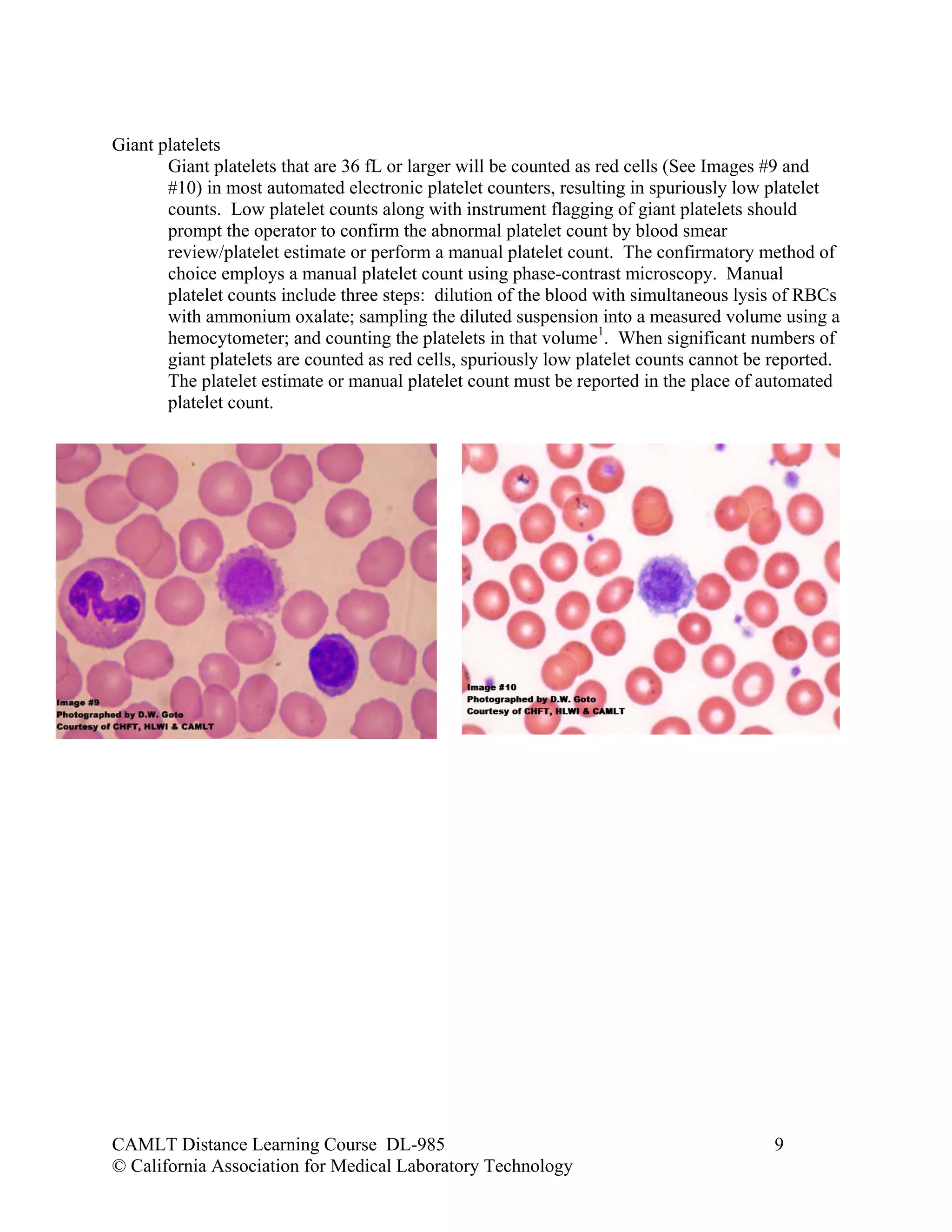 Hematology case studies: Platelets | PDF