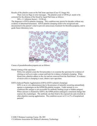Hematology case studies: Platelets | PDF
