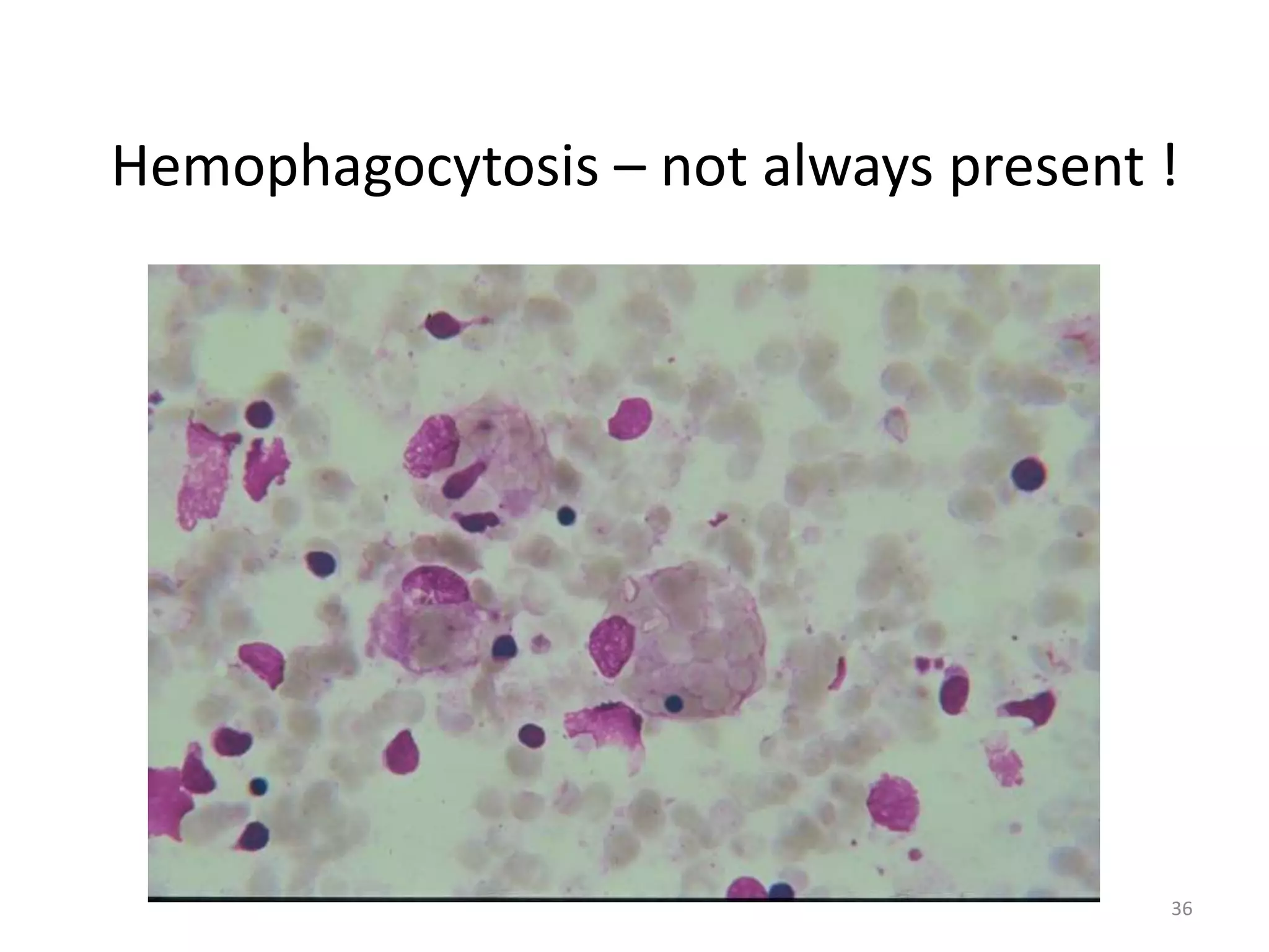 Hemophagocytic lymphohistocytosis Awareness HLH | PPTX