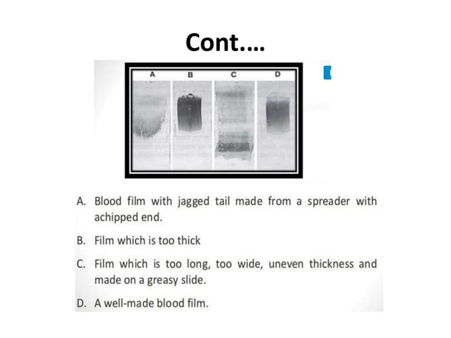 HEMATOLOGY PRACTICAL NOTES.pptx | Blood Disorders | Diseases and Conditions