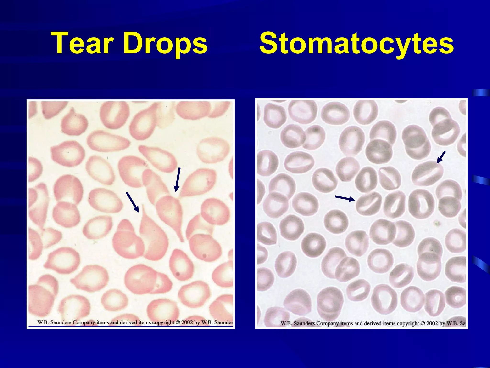 Hematology review '04 | PPT