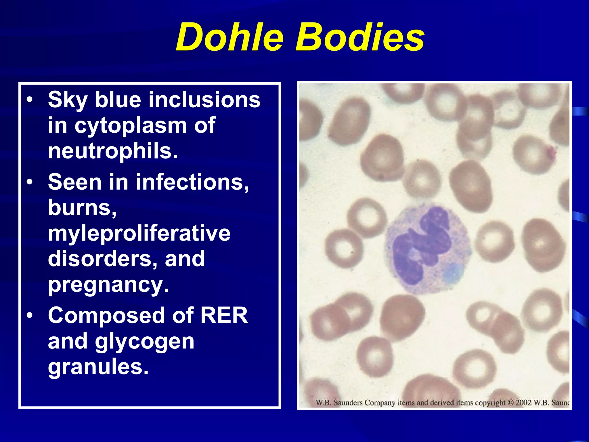 Hematology review '04 | PPT