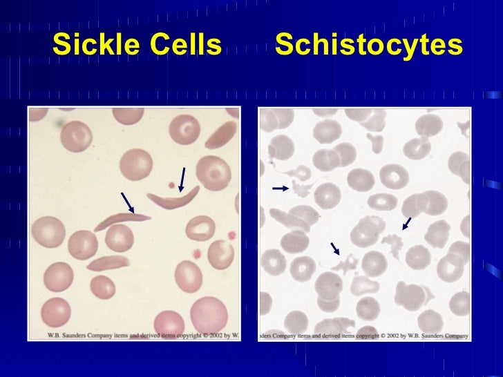 Hematology Review 04