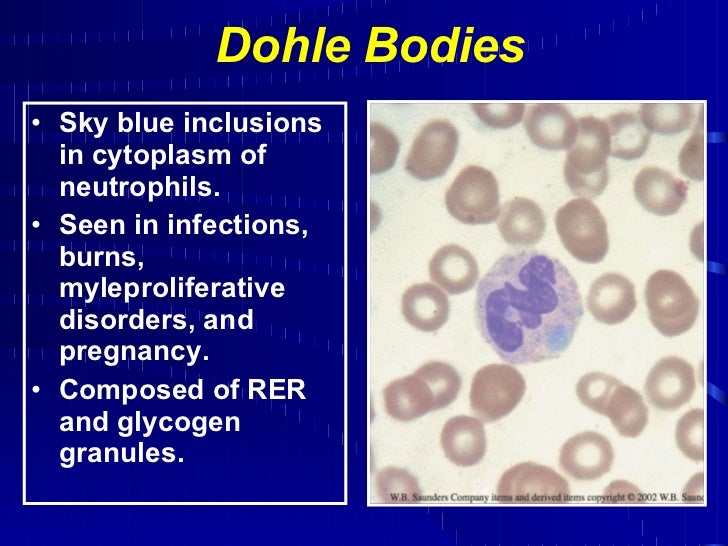 Dohle Bodies In Neutrophils : Test Three Hematology at Brown Mackie ...