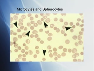 Hematology Rivas2008 Lecture1 | PPT