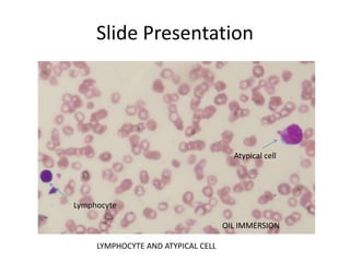 Hematology slide/ Pediatric leukemia | PPTX