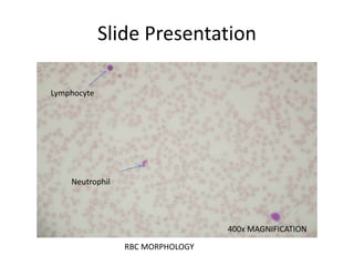 Hematology slide/ Pediatric leukemia | PPTX