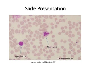 Hematology slide/ Pediatric leukemia | PPTX