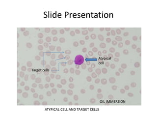 Hematology slide/ Pediatric leukemia | PPTX