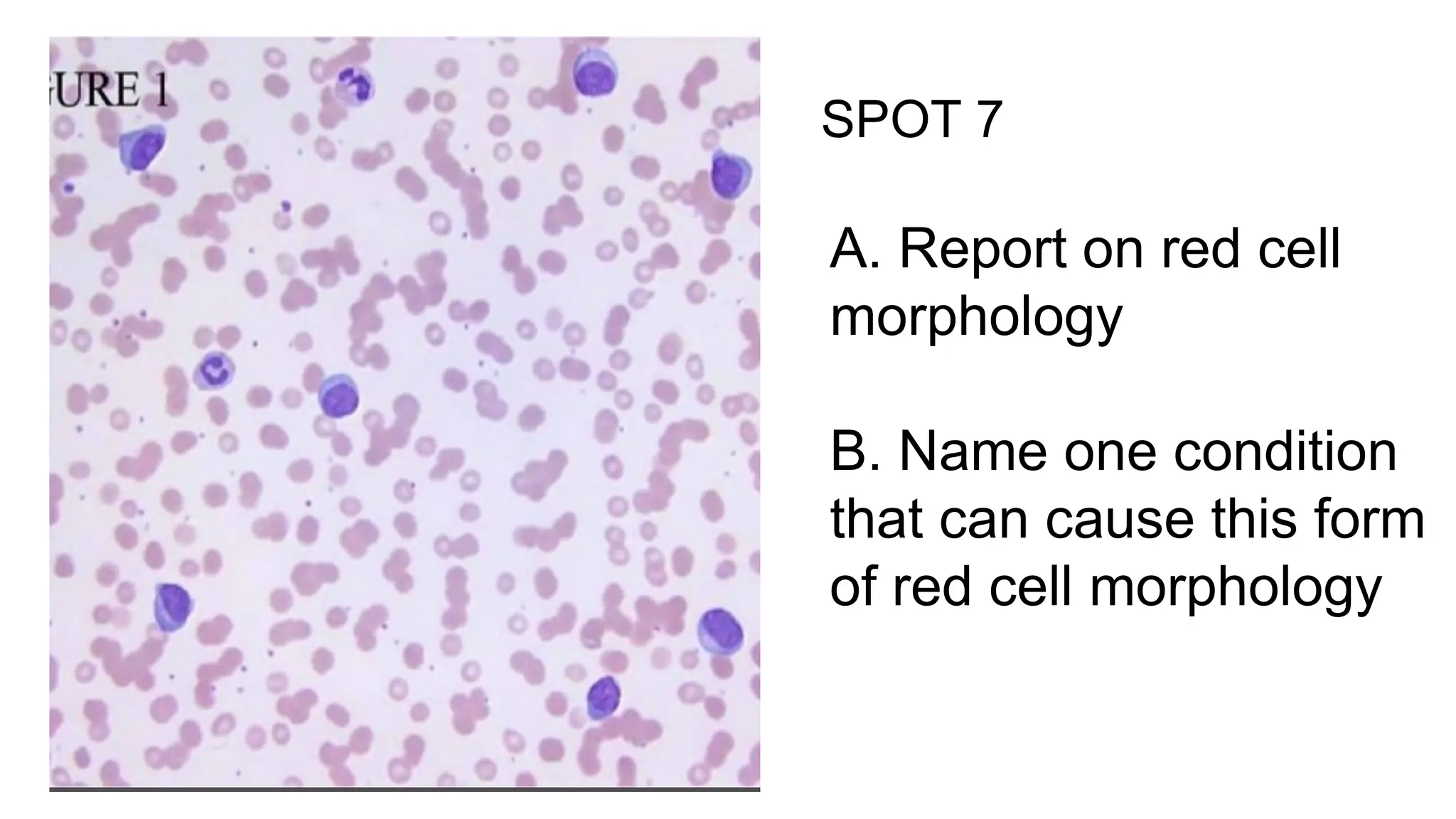 Hematology and Blood Transfusion Spots.pptx