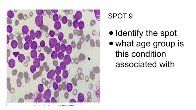 Hematology and Blood Transfusion Spots.pptx