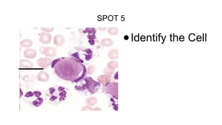 Hematology and Blood Transfusion Spots.pptx