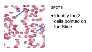 Hematology and Blood Transfusion Spots.pptx