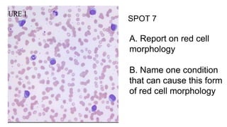 Hematology and Blood Transfusion Spots.pptx