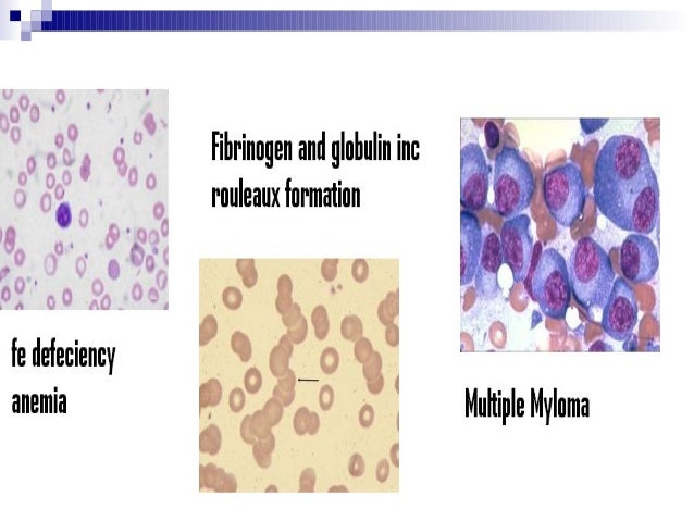 Hematology technique 1