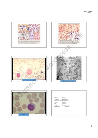 Hematolojide tanı yöntemleri | PDF