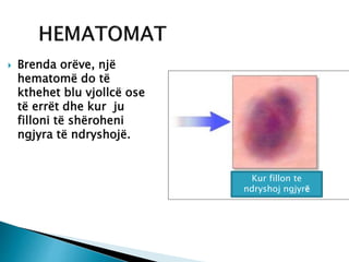 Hematomatt | PPTX