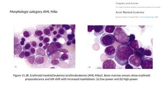 Hematopoetic lineage concept to proove surface marker in flowcytometry ...