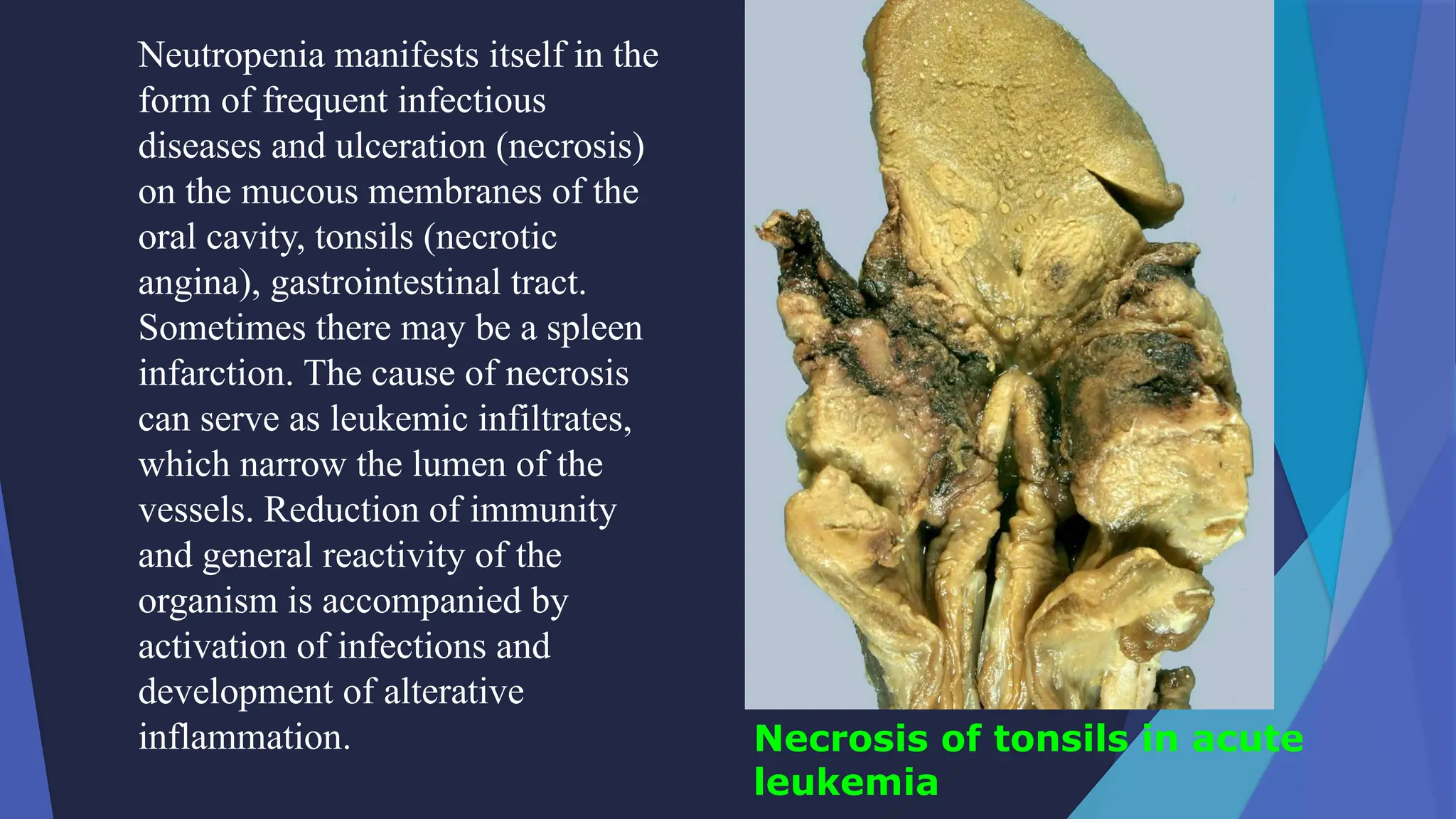 Hematopoetic system of blood system pathology | PPTX