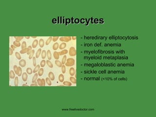 Hematopoiesis 06 07 | PPT